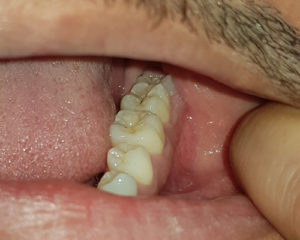 How to take good photos Manchester - Emergency Dentist Stretford